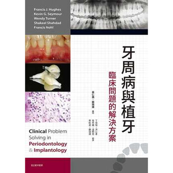 【中图原版】原版进口 牙周病与植牙临床问题的解决方案 中国台湾爱思唯尔