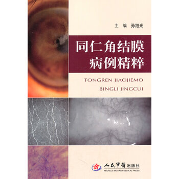 同仁角结膜病例精粹 孙旭光 人民军医出版社