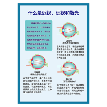 近视宣传画海报挂图保护视力远视表远视图眼睛视力训练图墙贴画覆膜贴纸SCH WST25 近视远视 120*80厘米 PP覆膜贴纸