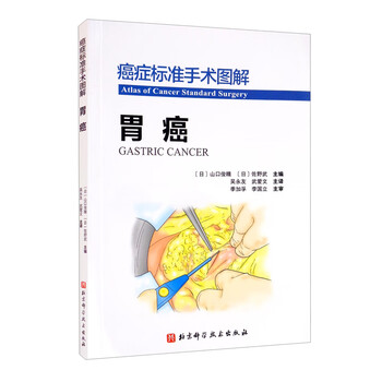 癌症标准手术图解：胃癌