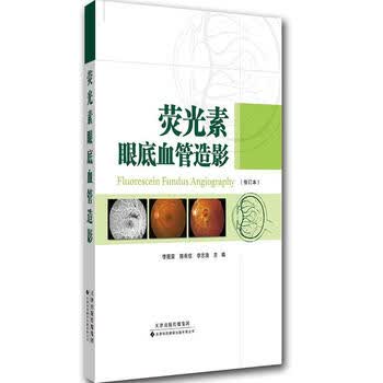 荧光素眼底血管造影医学 青年图书