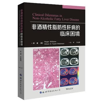 非酒精性脂肪性肝病的临床困境