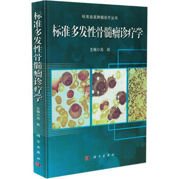 标准多发性骨髓瘤诊疗学