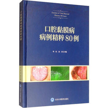 口腔黏膜病病例精粹80例