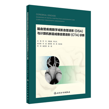 脑血管疾病数字减影血管造影（DSA）与计算机断层成像血管造影（CTA）诊断