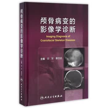 颅骨病变的影像学诊断(精)
