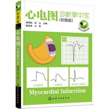 心电图诊断掌中宝（彩图版）
