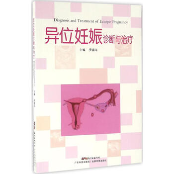异位妊娠诊断与治疗