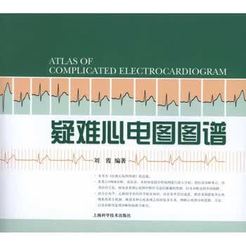 疑难心电图图谱