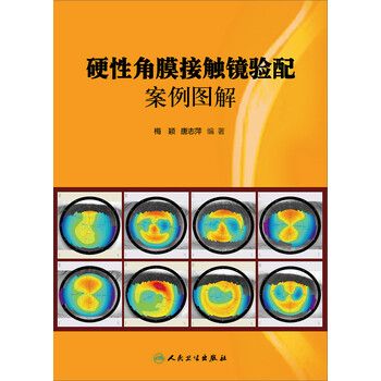 硬性角膜接触镜验配9787117208857人卫
