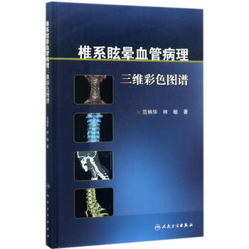 椎系眩晕血管病理三维彩色图谱