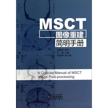 {正版新书}MSCT图像重建简明手册9787535958372