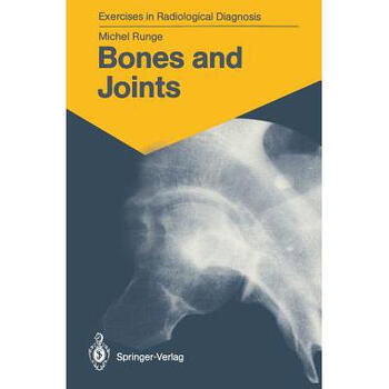 Bones and Joints: 170 Radiological Exercises...