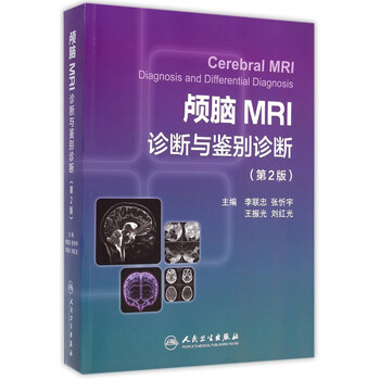颅脑MRI诊断与鉴别诊断(第2版)