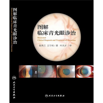 图解临床青光眼诊治
