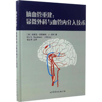 脑血管重建