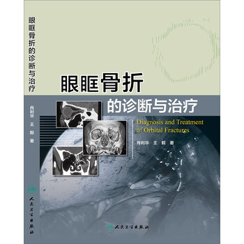 [正版图书]眼眶骨折的诊断与治疗