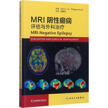 MRI阴性癫痫