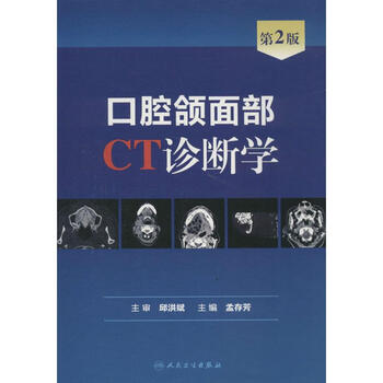 口腔颌面部CT诊断学(第2版)