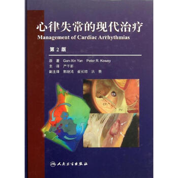 心律失常的现代治疗(翻译版)