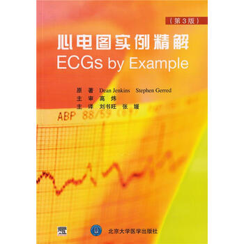 心电图实例精解（E）
