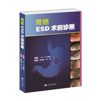 胃癌ESD术前诊断
