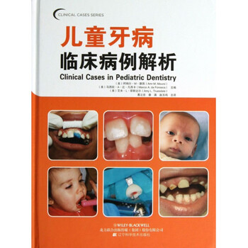 儿童牙病临床病例解析(精)