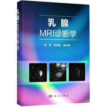 乳腺MRI诊断学