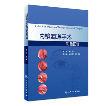 内镜泪道手彩色图谱