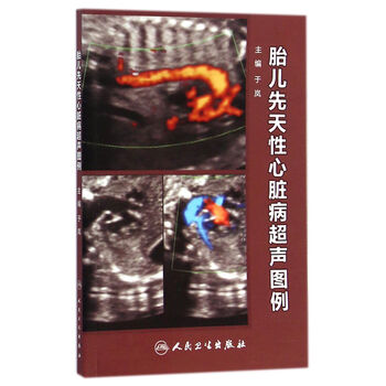 胎儿先天性心脏病超声图例