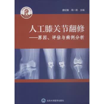 人工膝关节翻修