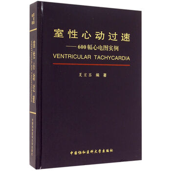 室性心动过速--600幅心电图实例(精)