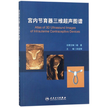 宫内节育器三维超声图谱