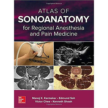 ATLAS OF SONOANATOMY 4 REGIONAL ANESTHES