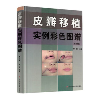 皮瓣移植实例彩色图谱（第2版）邢新主编 辽宁科学技术出版社