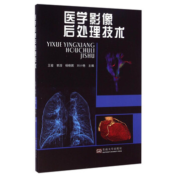 医学影像后处理技术