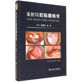 案析口腔黏膜病学