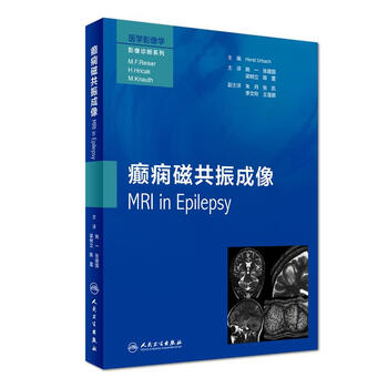 癫痫磁共振成像(翻译版)