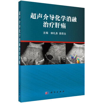超声介导化学消融治疗肝癌