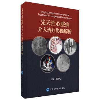 先天性心脏病介入治疗影像解析