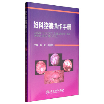 妇科腔镜操作手册